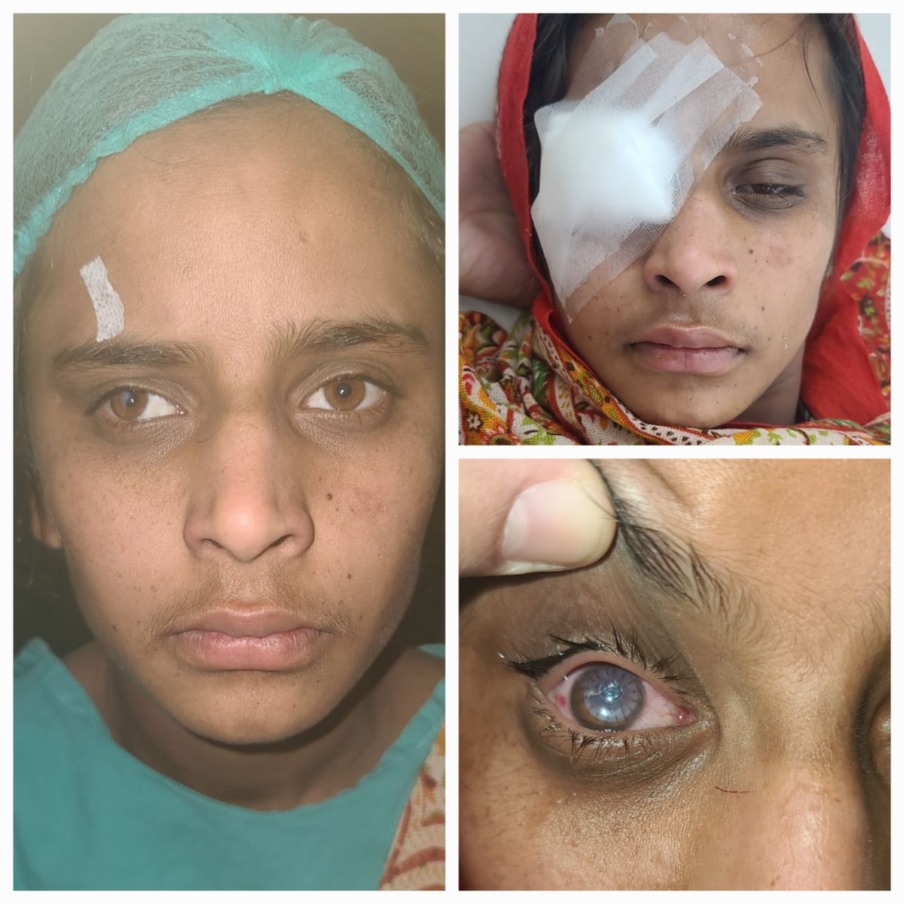 Ophthalmology/ Eye - Fauji Foundation Hospital Rawalpindi